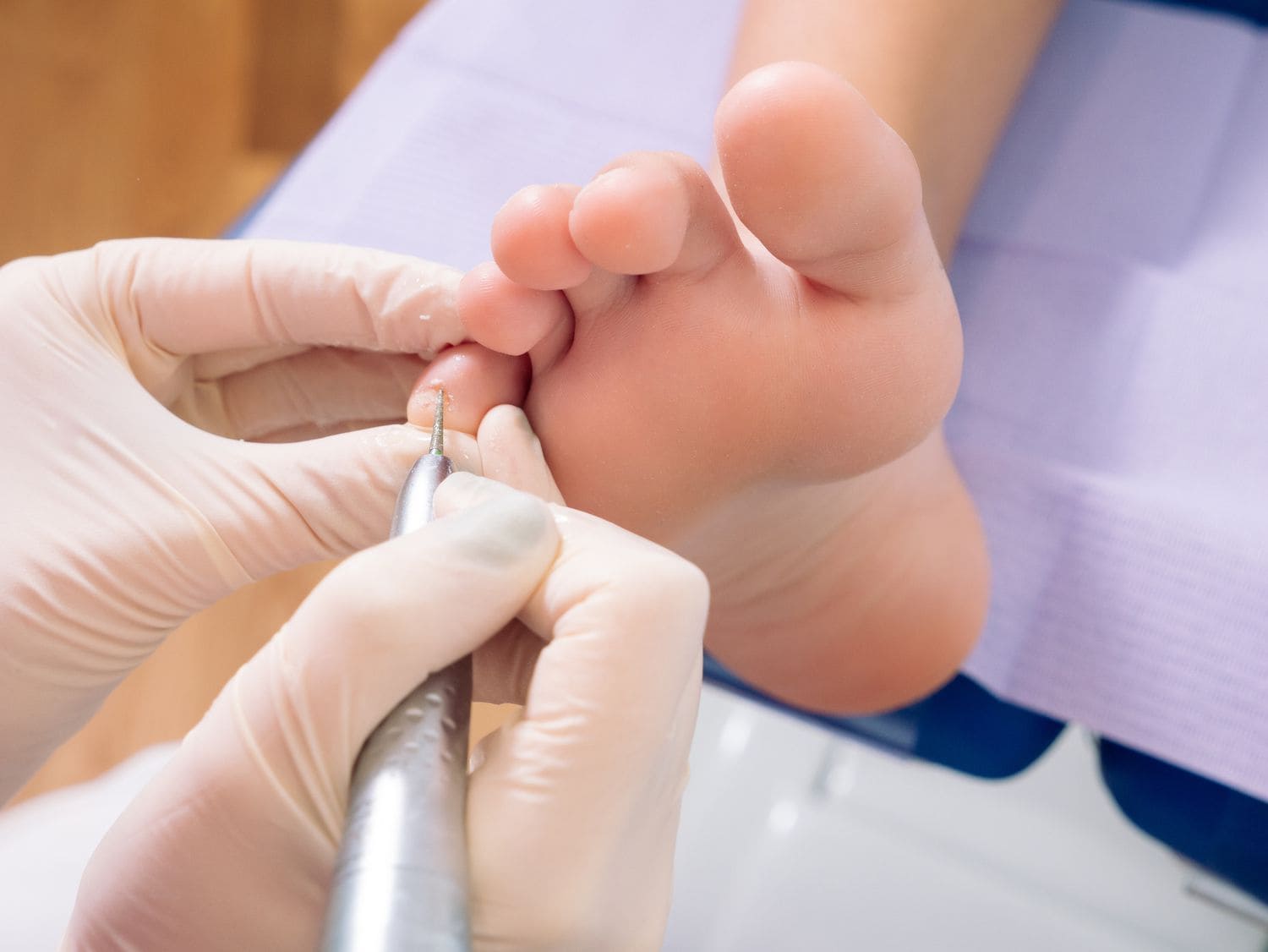The Mobile Podiatrist - Professional care, personal service right at ...